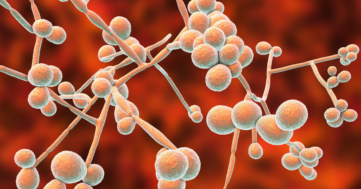 ¿Qué es la candidiasis oral? Causas y tratamiento - centropremoden